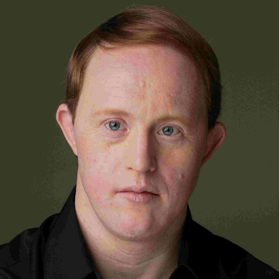 Identifying and Treating Anxiety in Adults With Intellectual and/or ...